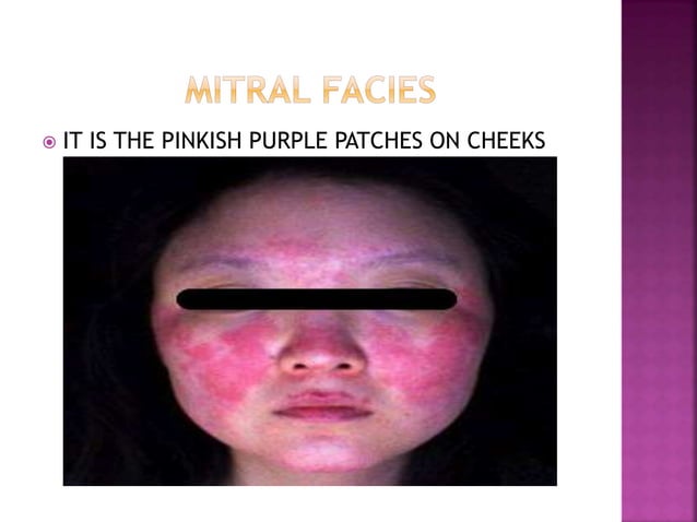 Different facies used in the diagnosis of disease | PPT