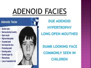 Different facies used in the diagnosis of disease | PPT