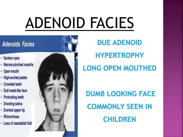 Different facies used in the diagnosis of disease | PPT
