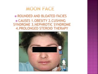 Different facies used in the diagnosis of disease | PPTX