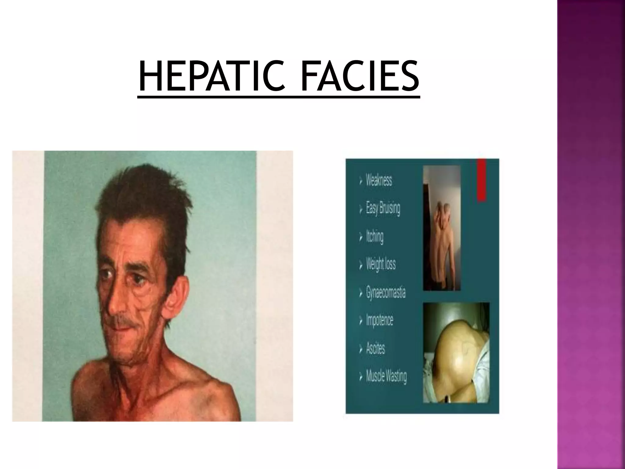 Different facies used in the diagnosis of disease | PPTX