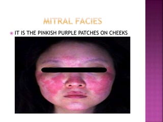 Different facies used in the diagnosis of disease | PPTX