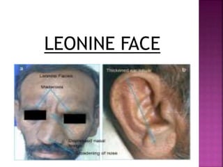 Different facies used in the diagnosis of disease | PPTX