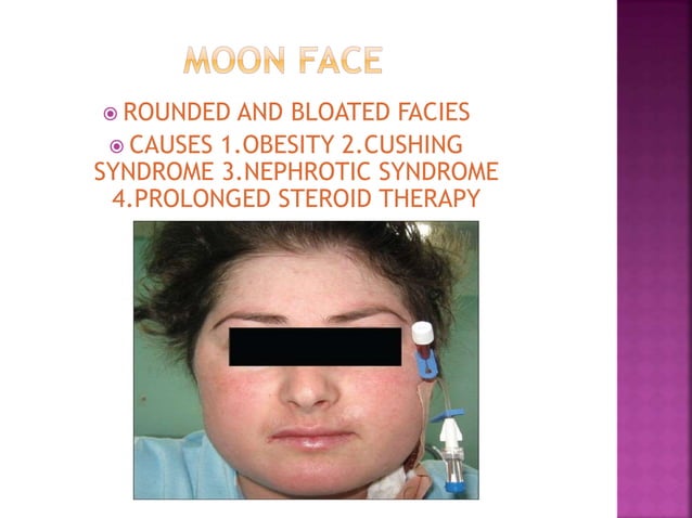 Different facies used in the diagnosis of disease | PPTX