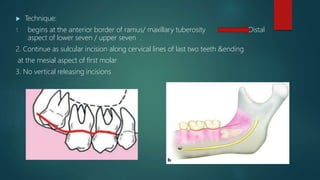 Different flap designs used for the management of impacted wisdom | PPTX