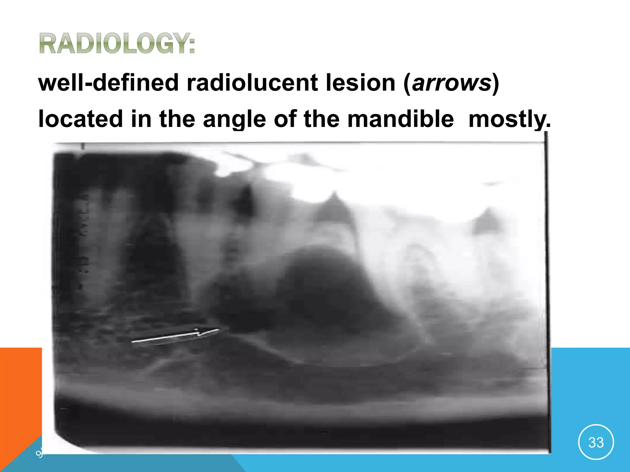 Differential diagnoses and management of mandibular radiolucent lesions ...