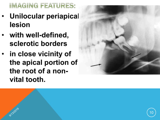 Differential diagnoses and management of mandibular radiolucent lesions ...