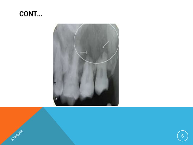 Differential diagnoses and management of mandibular radiolucent lesions ...
