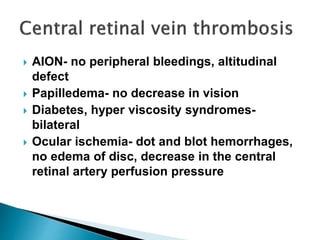 Differential diagnosis retina | PPT