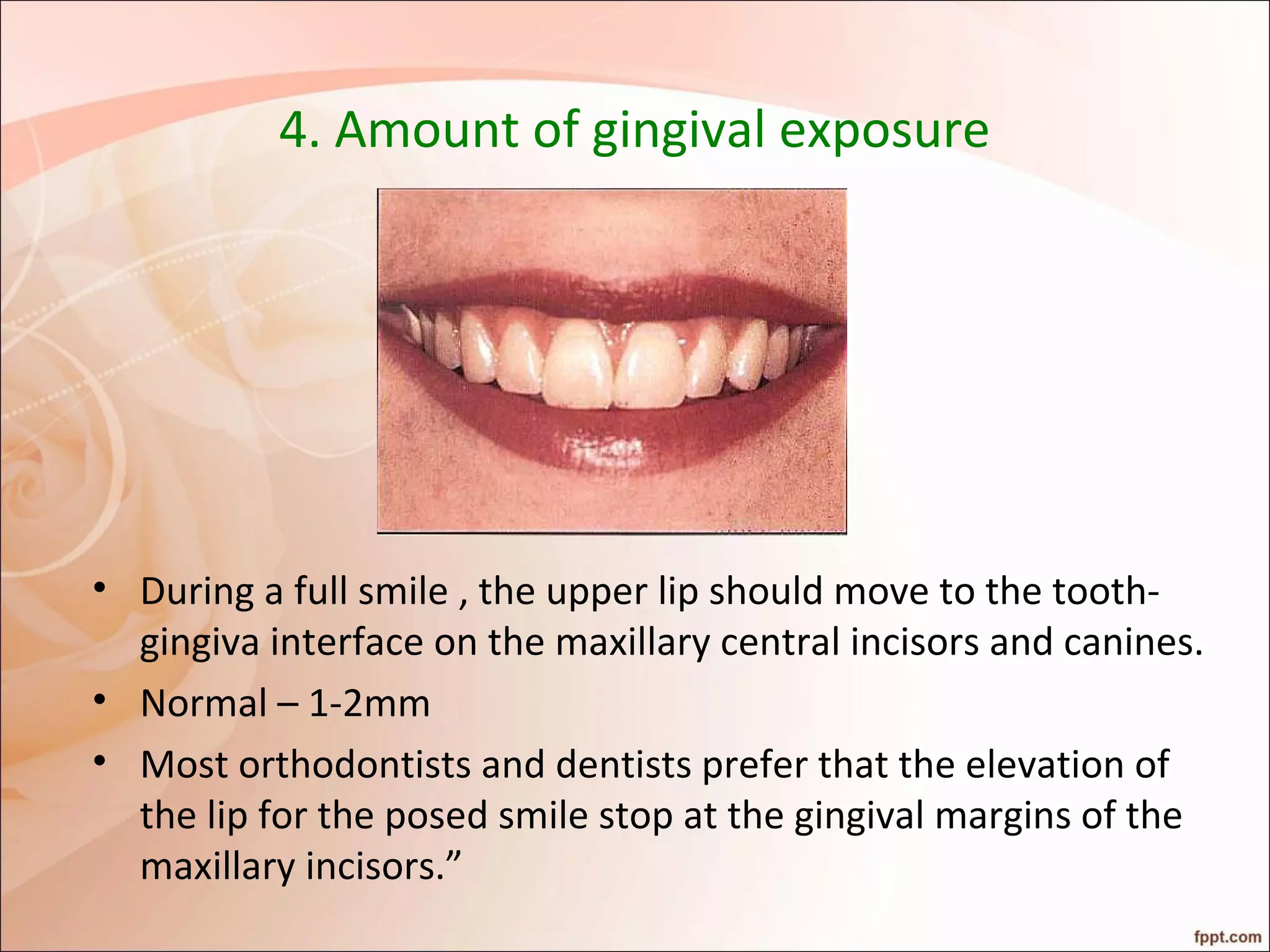 Differential diagnosis and management of gummy smile | PPT