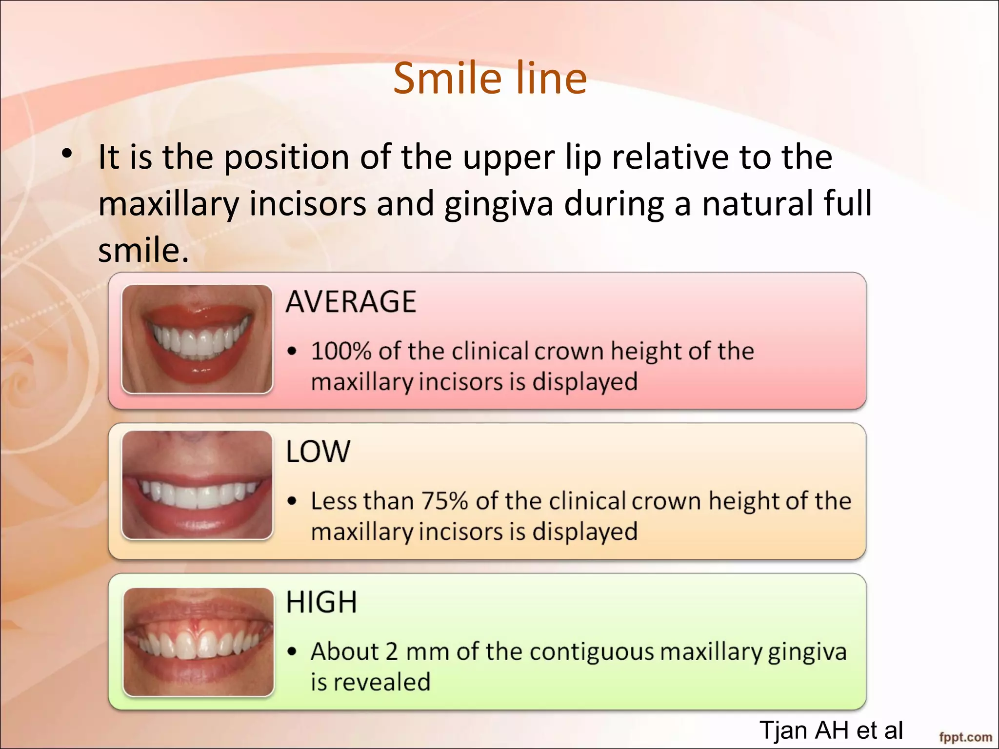 Differential diagnosis and management of gummy smile | PPT