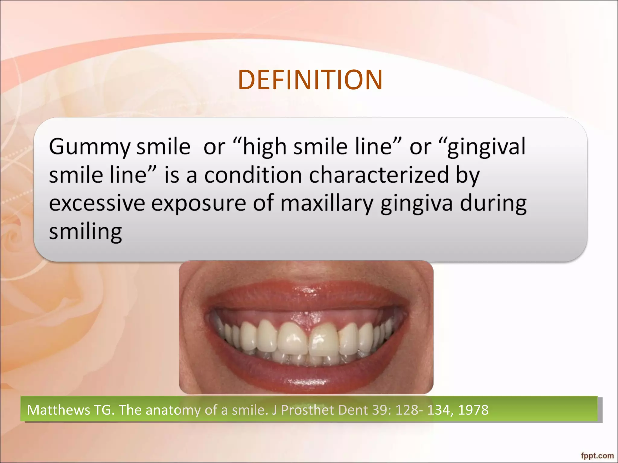 Differential diagnosis and management of gummy smile | PPT