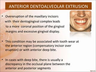 Differential diagnosis and management of gummy smile | PPT