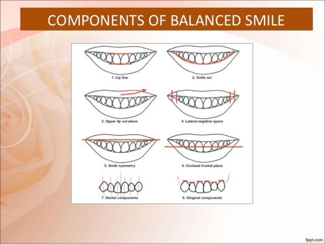 Differential diagnosis and management of gummy smile