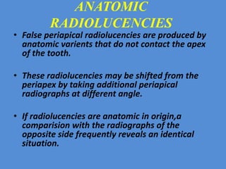 DIFFERENTIAL DIAGNOSIS FOR PERIAPICAL RADIOLUCENCY.pptx