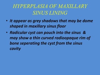 DIFFERENTIAL DIAGNOSIS FOR PERIAPICAL RADIOLUCENCY.pptx