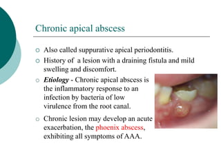 Differential Diagnosis in Endodontics | PPTX