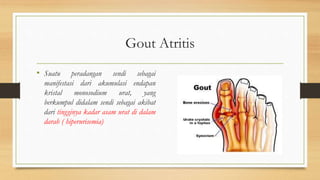 oDifferential diagnosis oa | PPT