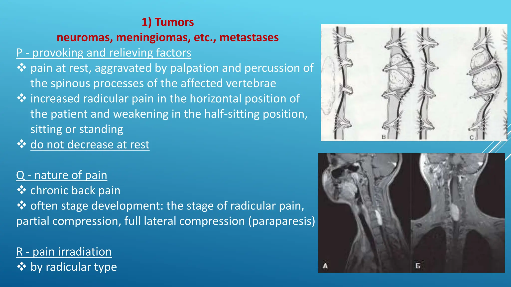 Differential diagnosis of back painv.ppt