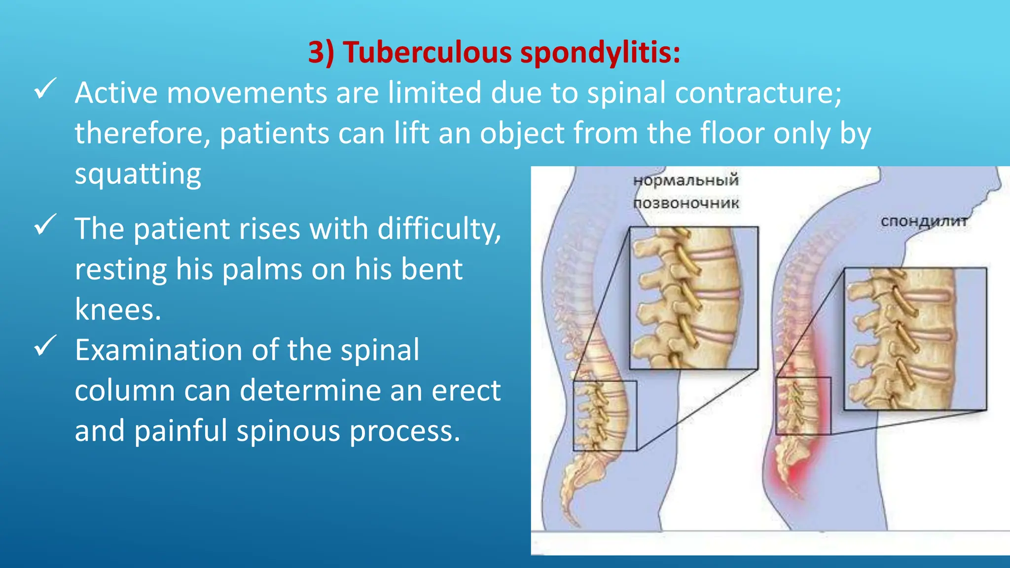 Differential diagnosis of back painv.ppt