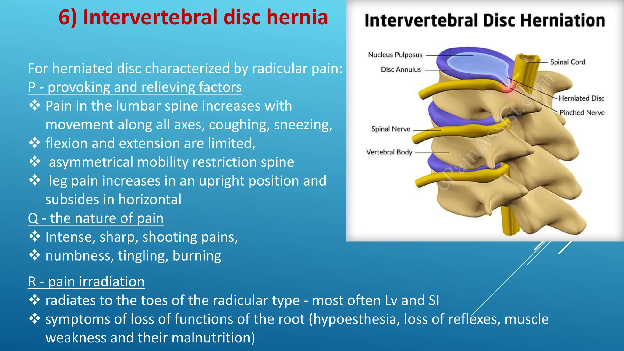 Differential diagnosis of back painv.ppt