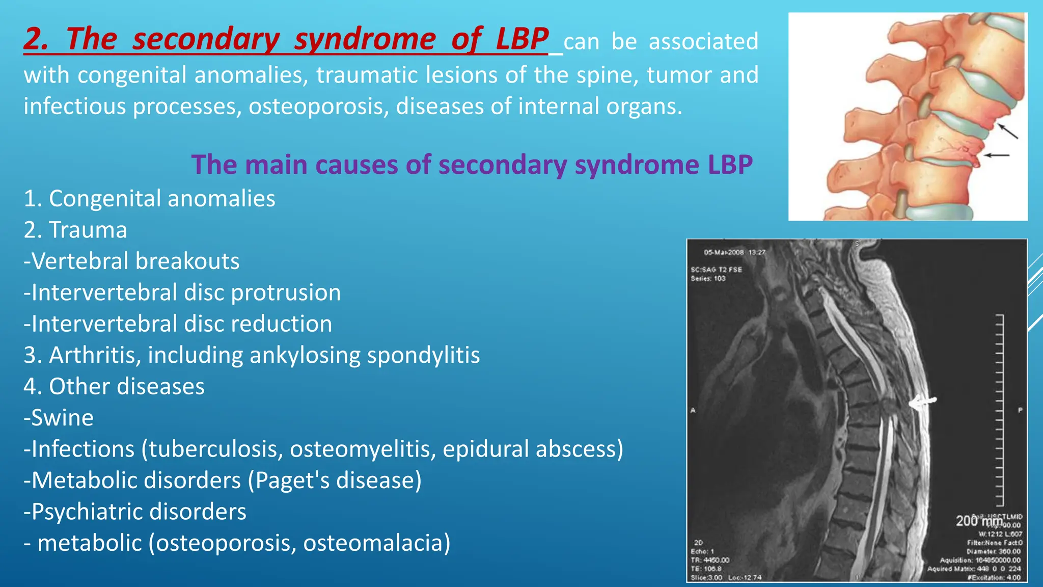 Differential diagnosis of back painv.ppt