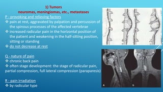 Differential diagnosis of back painv.ppt