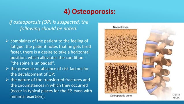 Differential diagnosis of back painv.ppt