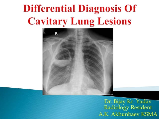 Differential diagnosis of cavitary lung lesions