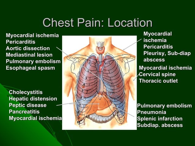 “Differential diagnosis of chest pain” by Dr Muhammad Farooque ...