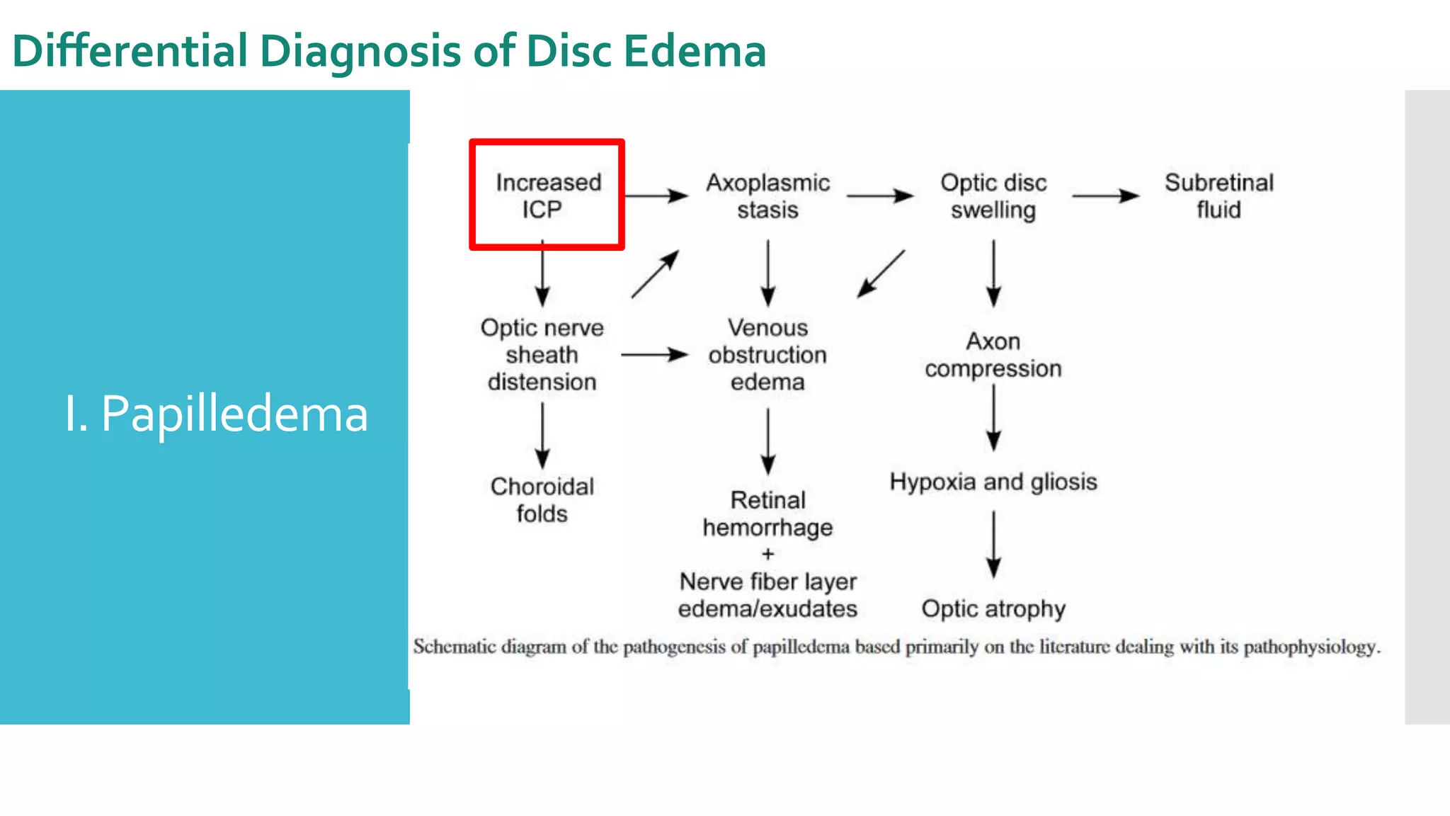 Differential Diagnosis of Disc Edema | PPTX