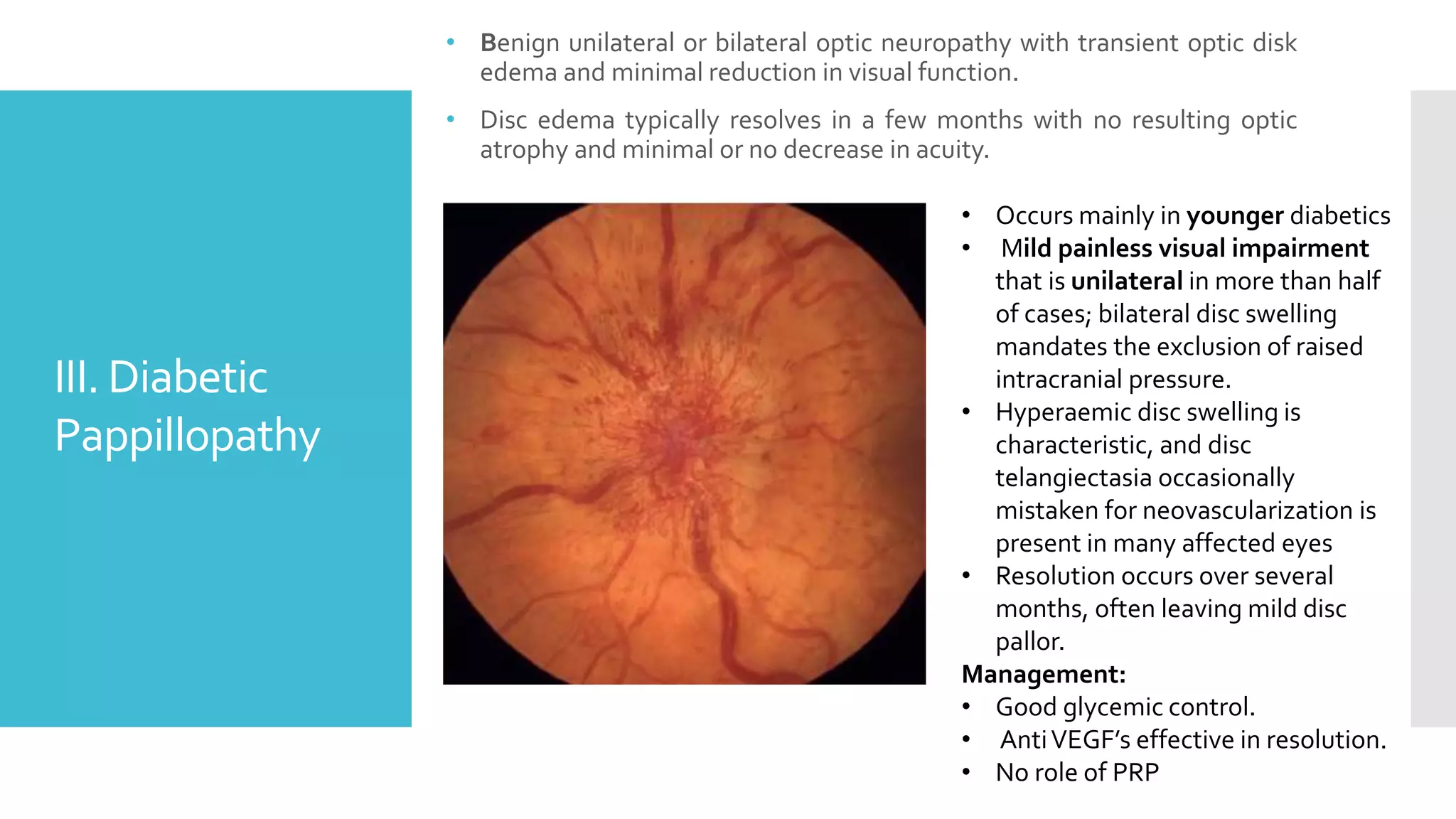 Differential Diagnosis of Disc Edema | PPTX