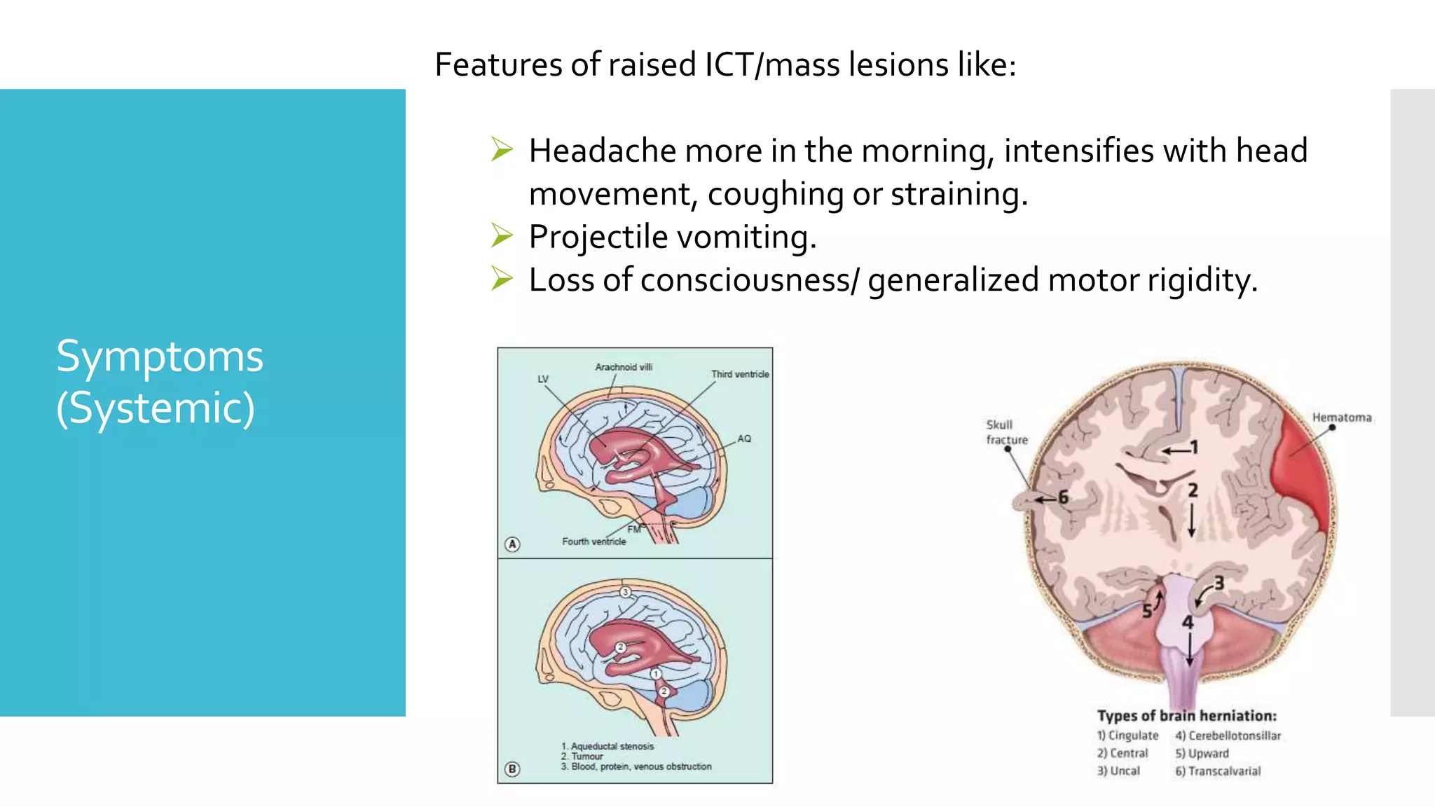 Differential Diagnosis of Disc Edema | PPTX