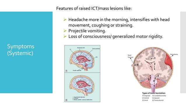 Differential Diagnosis of Disc Edema | PPTX | Eye and Vision Conditions ...