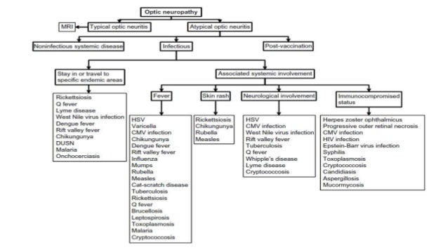 Differential Diagnosis of Disc Edema