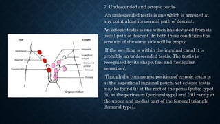 differential diagnosis of femoral hernia-Bhadra.pptx