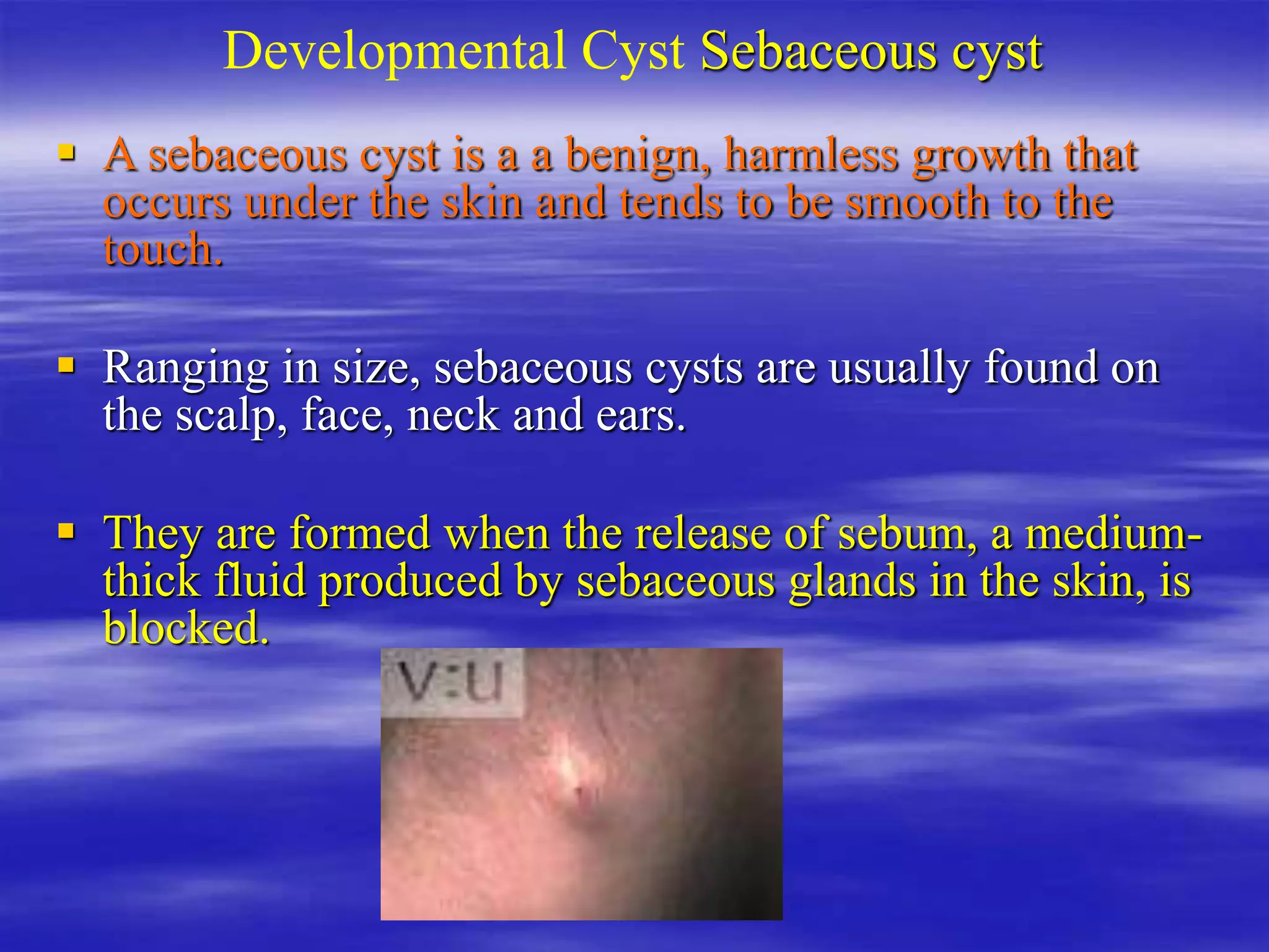 Differential diagnosis of head and neck swelling | PPT
