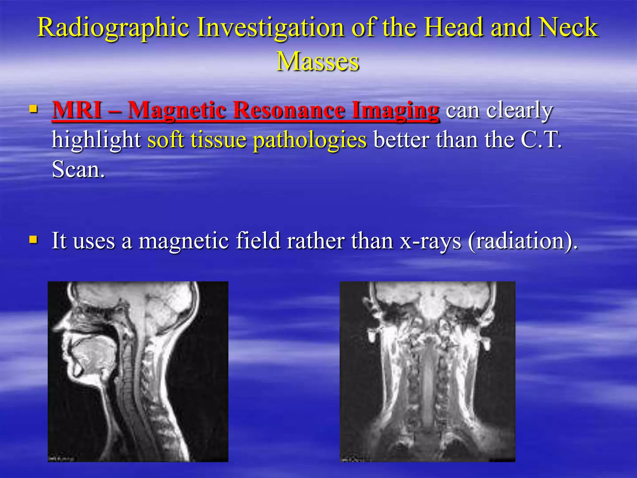 Differential diagnosis of head and neck swelling | PPT