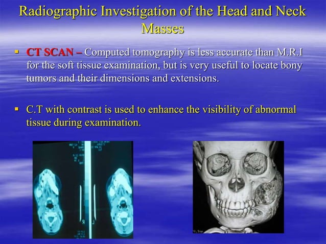 Differential diagnosis of head and neck swelling | PPT