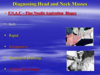 Differential diagnosis of head and neck swelling | PPT