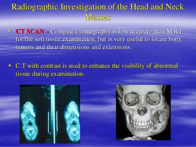 Differential diagnosis of head and neck swelling Differential diagnosis of head and neck swelling