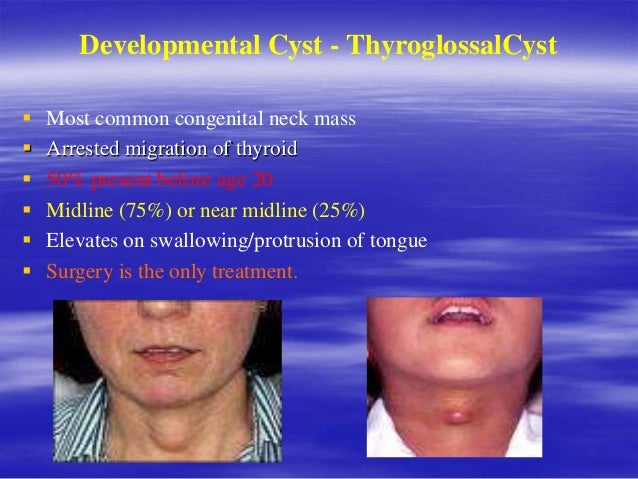 Differential diagnosis of head and neck swelling Differential diagnosis of head and neck swelling