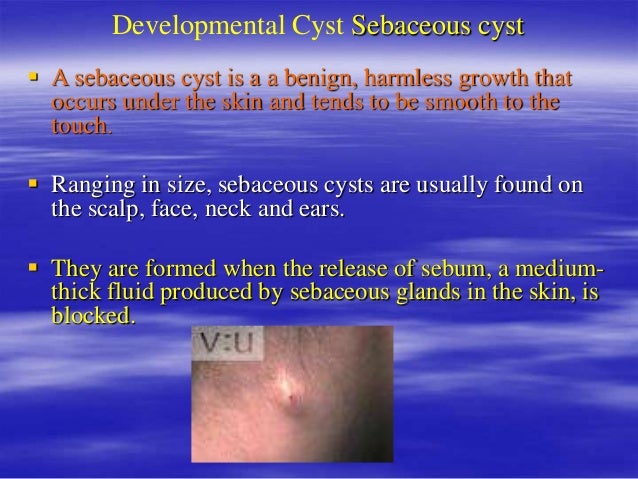 Differential diagnosis of head and neck swelling Differential diagnosis of head and neck swelling