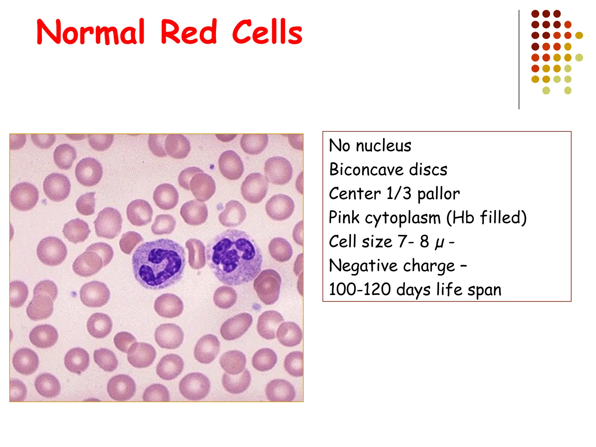 Differential diagnosis of hypochromic anemia.ppt