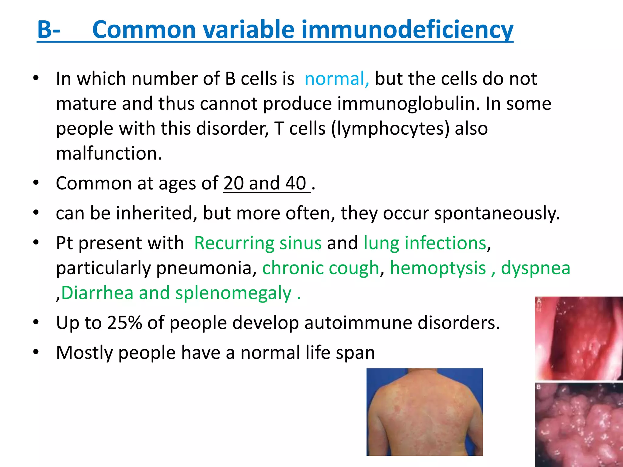 Differential diagnosis of immunodeficiency | PPT