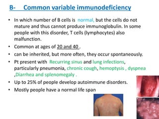 Differential diagnosis of immunodeficiency | PPT