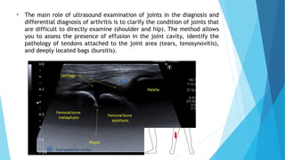 Differential diagnosis of joint pain.ppt