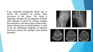 Differential diagnosis of joint pain.ppt