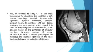 Differential diagnosis of joint pain.ppt