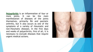 Differential diagnosis of joint pain.ppt